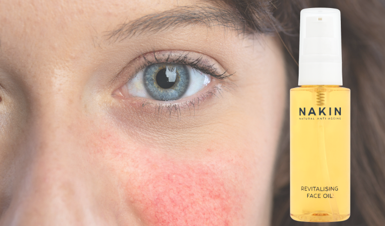 Calming Oil for Reduced Facial Redness– Nakin Skincare